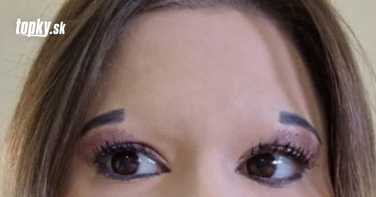 Andrea (25) má vraj najväčšie pery na svete: A ešte neskončila! Fúha ...