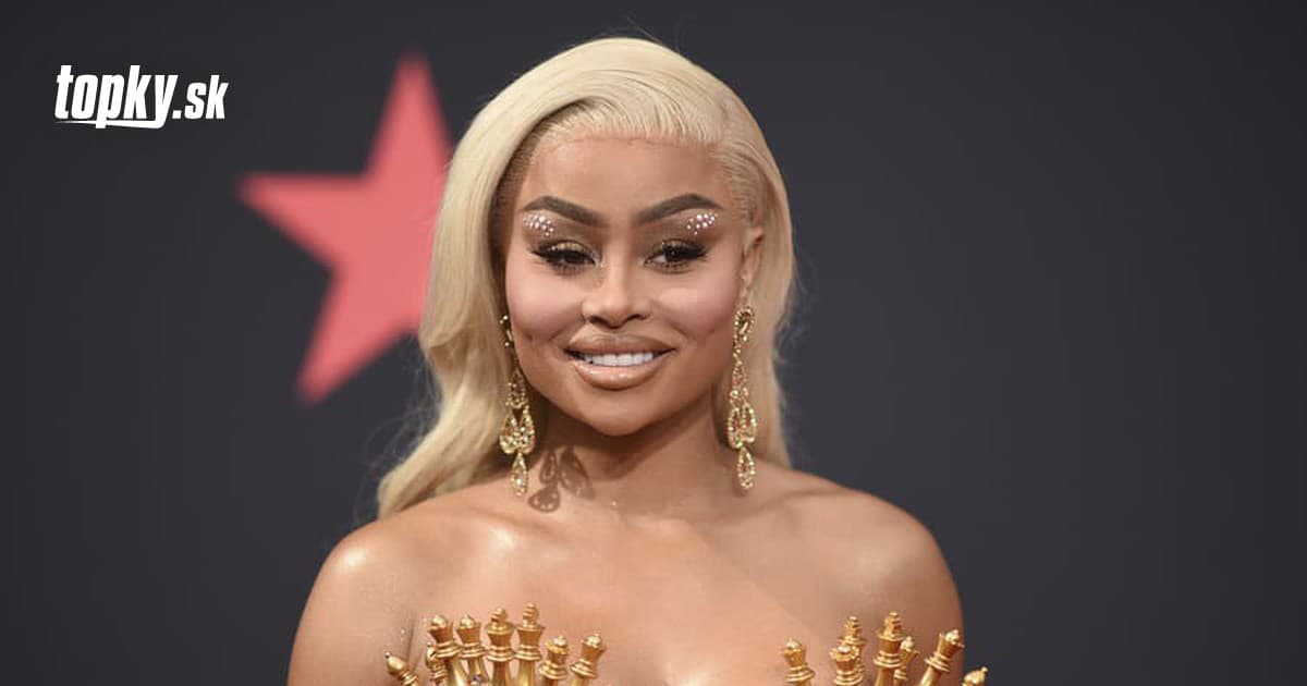 Slávna modelka v UKRUTNÝCH BOLESTIACH: Plastická operácia nedopadla ...